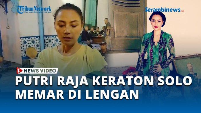 VIDEO Devi Lelyana Dewi Putri Raja Keraton Solo Alami Memar di Tangan Saat Bentrokan ...