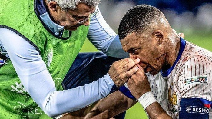 Kondisi Kylian Mabppe Usai Cedera Patah Hidung, Tak Perlu Operasi, Siap ...