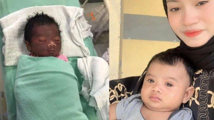 Kulit Bayi Ini Menghitam saat Lahir Bikin Ibunya Syok, Penampilan Sang ...
