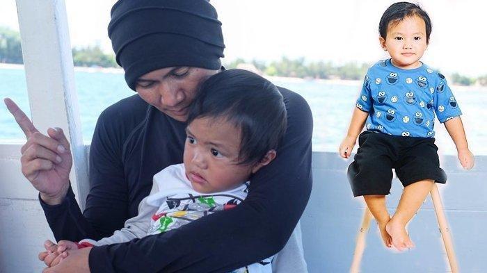 Setelah Tangan Sembuh dari Kemasukan Cacing, Dagu Anak Anji Kini ...