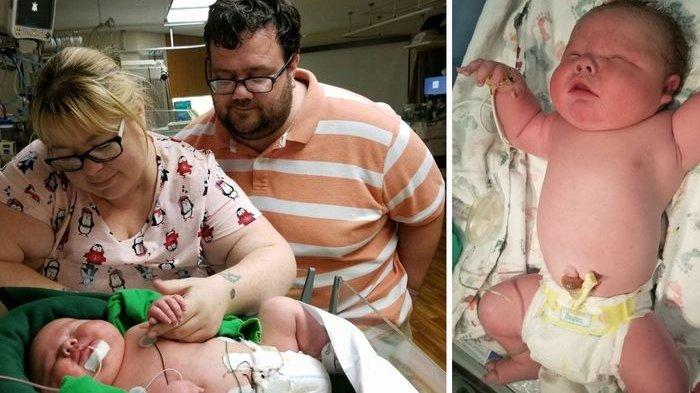 Baby Ali Lahir Dengan Berat Hampir 6,8 Kg, Pecahkan Rekor Rumah Sakit ...