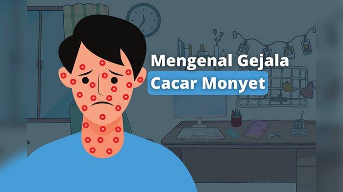 Mengenal Gejala Cacar Monyet - Serambinews.com
