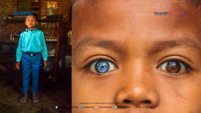 FOTO - Melihat Orang-orang Bermata Biru Dari Minangkabau - Serambinews.com