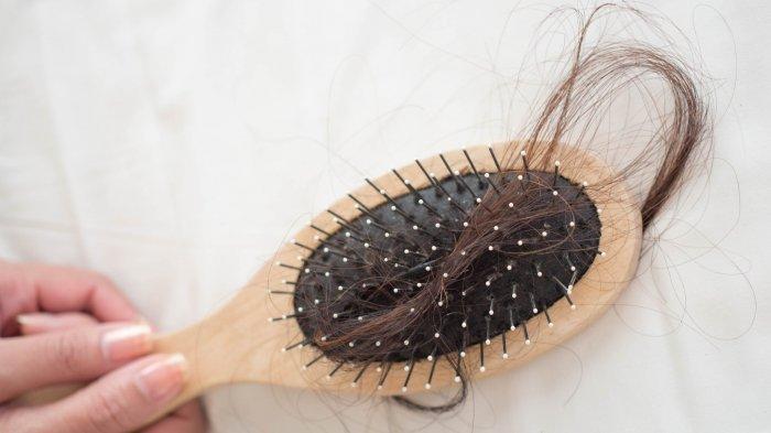 Berikut Ada 8 Cara Mengurangi Rambut Rontok, Mudah dan Dapat Dilakukan ...