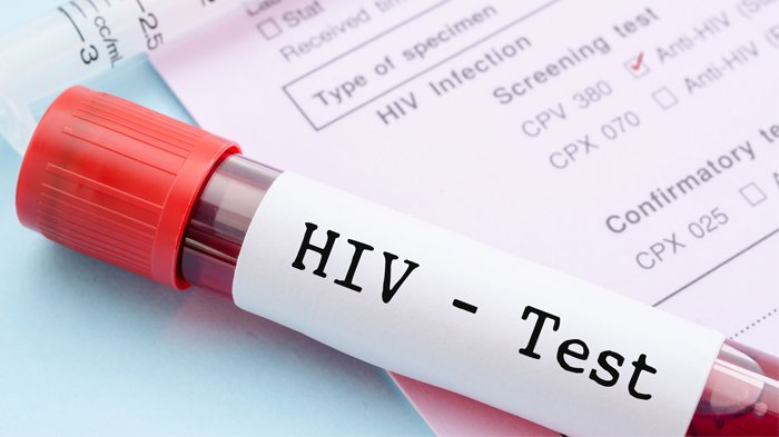 Waspadai Gejala HIV pada Pria, Demam Hingga Pembengkakan Kelenjar Getah ...