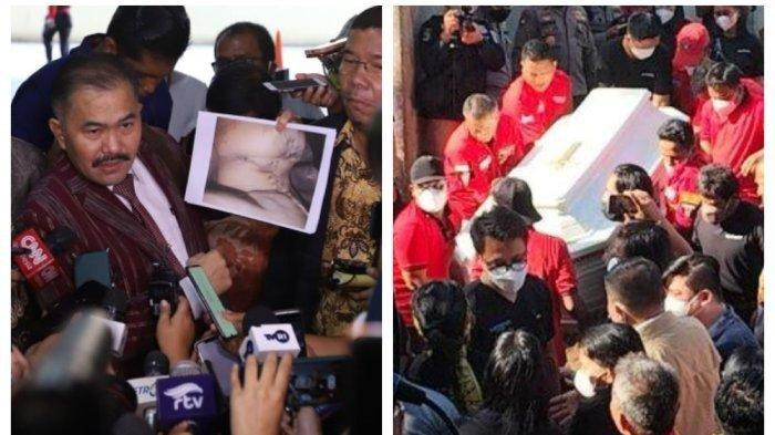 Hasil Autopsi Ulang Jenazah Brigadir J: Ditemukan 5 Luka Tembak, Bagian Ini Paling Parah ...