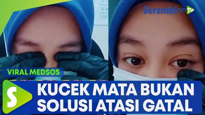 VIDEO VIRAL Kucek Mata Bukan Solusi Atasi Gatal, Begini Penjelasan ...