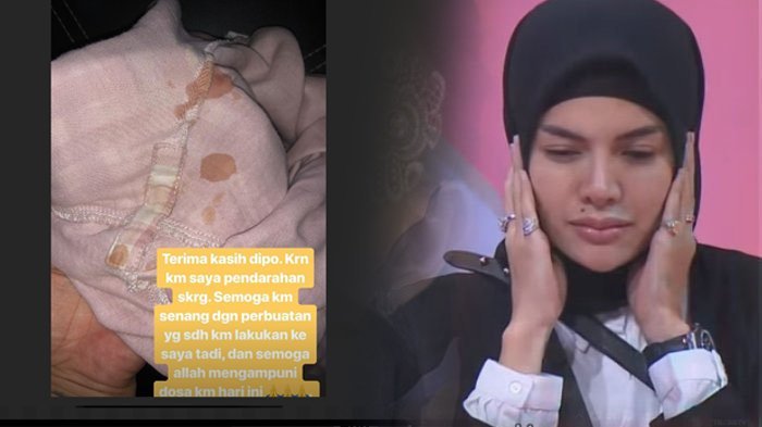 Alami Pendarahan, Nikita Mirzani: Terima Kasih Dipo Latief, Semoga ...
