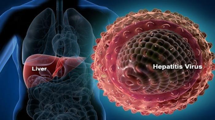 Gejala Hepatitis Akut, Begini Cara Pencegahannya - Serambinews.com