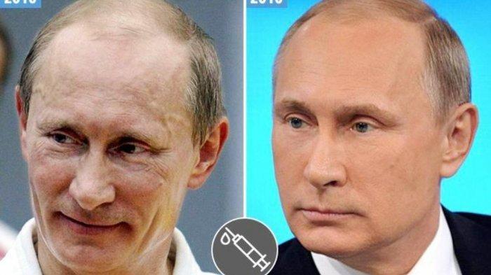Perubahan Wajah Presiden Vladimir Putin dari Masa ke Masa, Terlihat ...