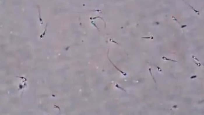 Setiap Hari Mengeluarkan Sperma, Apakah Berbahaya atau Justru Menyehatkan? - Serambinews.com