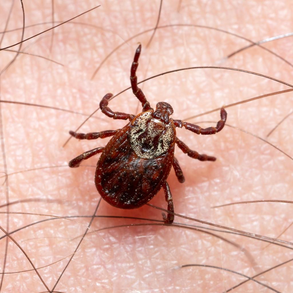 China Temukan Virus Baru Bernama Xue-Cheng, Telah Infeksi 252 Orang Dalam 3 Bulan, Ini Gejalanya ...