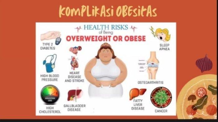 7 Tips Menghindari Obesitas Pada Orang Dewasa, Cegah Sedini Mungkin ...