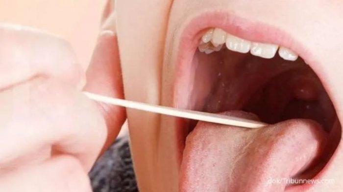 WASPADA, Ini 14 Gejala Umum Radang Amandel pada Anak, Ini Cara Terbaik ...