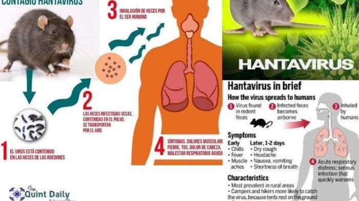 Muncul di China, Apa Itu Hantavirus, Adakah Obatnya? - Tribun-bali.com