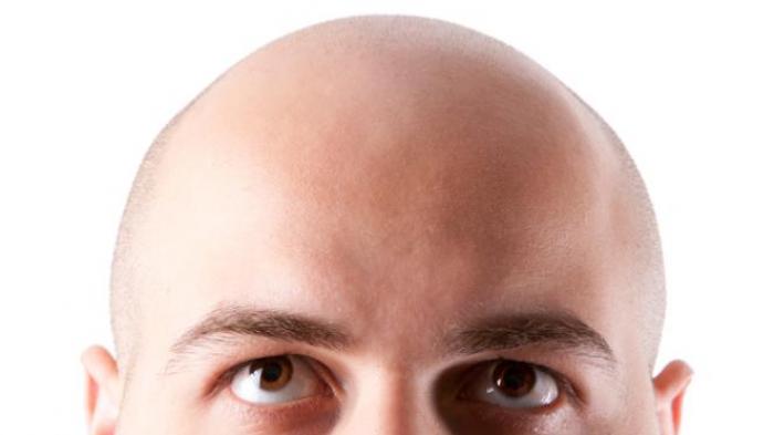 6 Arti Mimpi Tentang Botak, Pertanda Anda Dalam Bahaya dan Ada ...