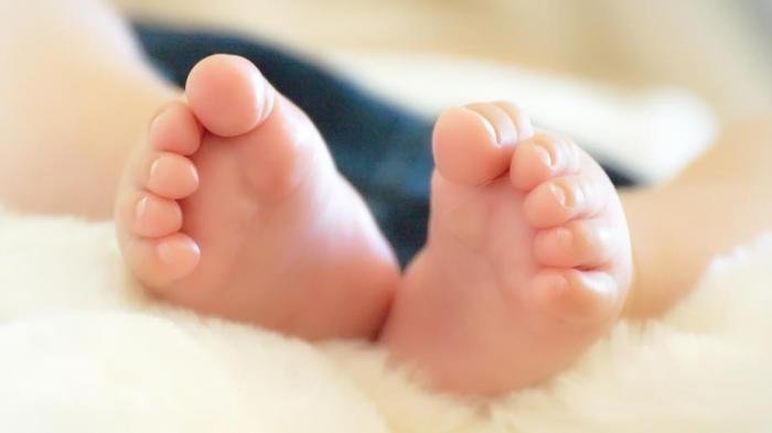 Pentingnya Deteksi Dini Kaki Pengkor atau Congenital Talipes Equinus ...