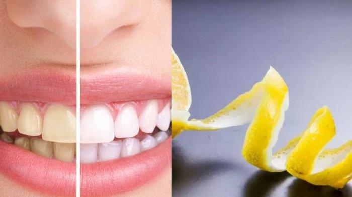 Gigi Kuning Bikin Gak Percaya Diri, Ikuti 7 Tips Memutihkan Gigi Secara Alami - Tribun-bali.com