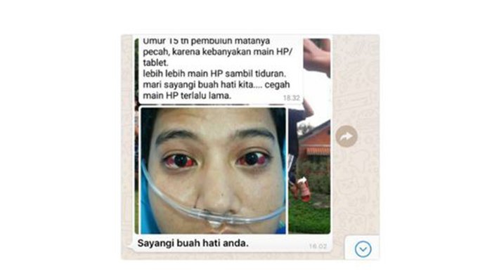 Beredar di Medsos, Mata Merah karena Main Ponsel Sambil Tiduran, Ini ...