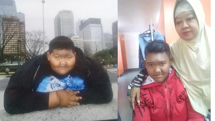 Perubahan Drastis Arya Permana, Dulu Obesitas & Kini Berat Badannya ...