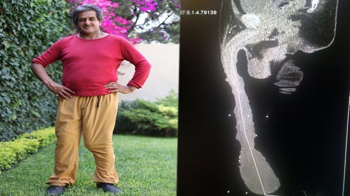 Pria Ini Miliki Penis Terpanjang di Dunia, Saat Berhubungan Intim ...