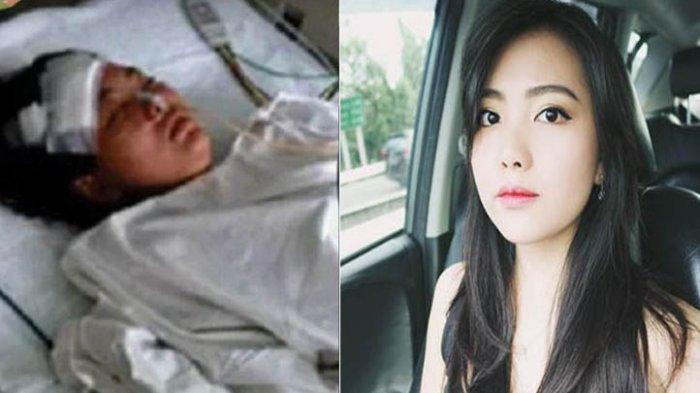 Nyaris Tewas Ditusuk Temannya yang Psikopat, Listya Magdalena Kini Jadi Youtuber Sukses di ...