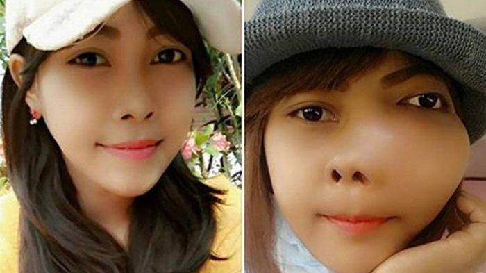 Sepelekan Sakit Gigi hingga Wajahnya Bengkak, Wanita Cantik Ini ...
