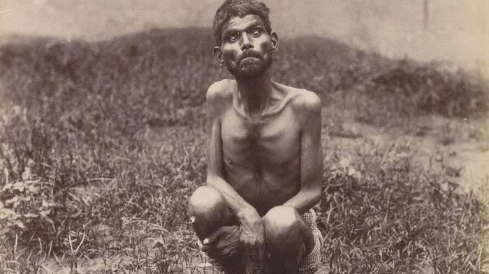 Kisah Hidup Dina Sanichar, Dibesarkan Serigala di Hutan dan Hanya Bisa ...