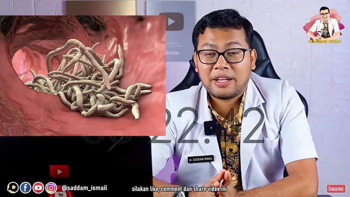 Gatal di Area Anus dan Sakit Perut, Bisa Jadi Terinfeksi Cacing Kremi, Kata dr Saddam Ismail ...