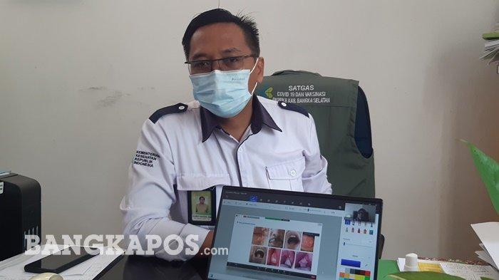 Bangka Belitung Waspadai Cacar Monyet, Inilah Gejala dan Penularan ...