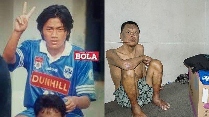 Kondisi Budiono Sutikno, Eks Striker PSIS Semarang Kian Memprihatinkan ...
