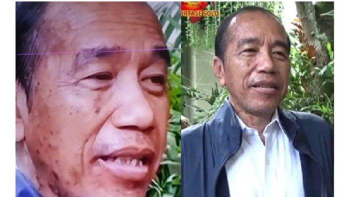 Jokowi Sakit Apa, Wajah dan Leher Penuh Bercak Hitam, Dokter Tifa ...