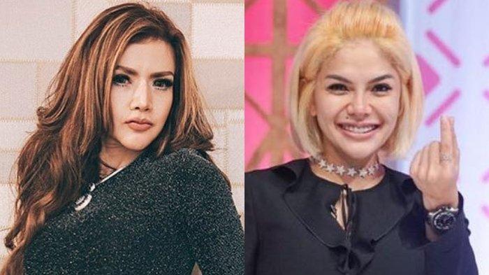 Biaya Perawatan Barbie Kumalasari Rp 8 M Ditertawakan Netizen, Ini Selebritis yang Pamer Saldo ...