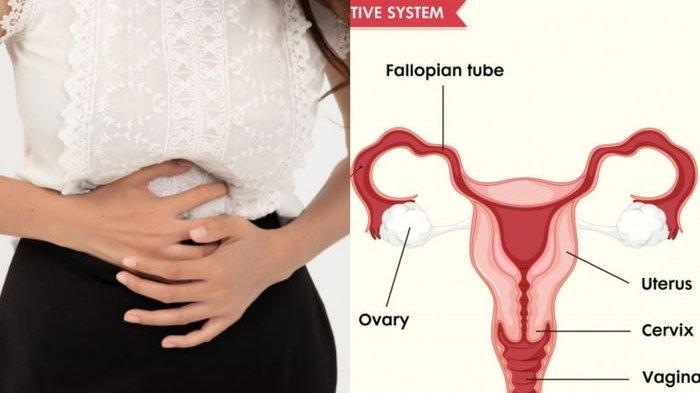 Kenali Apa Itu Kanker Servik Berikut Gejala Serta Cara Pengobatannya, Ini Penjelasan Dokter ...