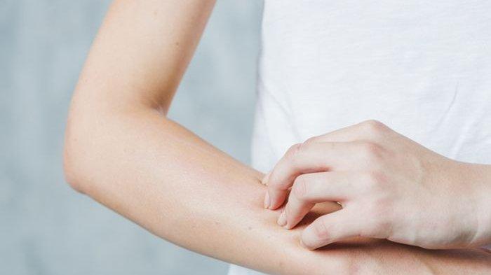 Kenali 5 Gejala Umum Penyakit Autoimun - Bangkapos.com