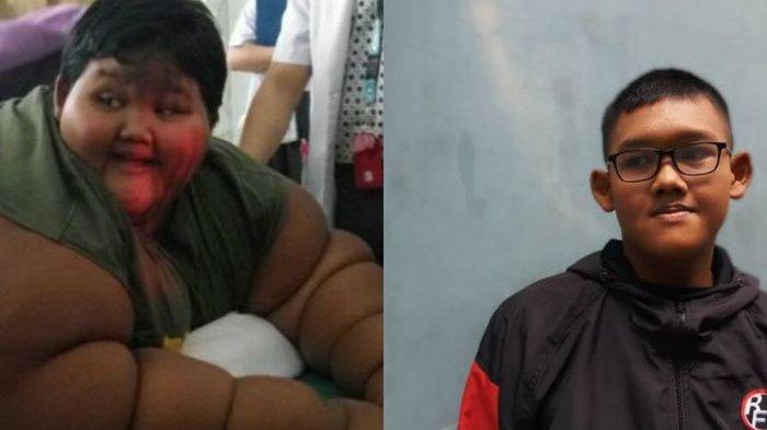 Dulu Sulit Bergerak Karena Kegemukan, Lihat Badannya Sekarang, Arya ...