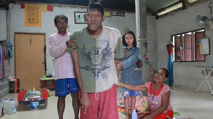 Orang Tertinggi Di Dunia Yang Masih Hidup