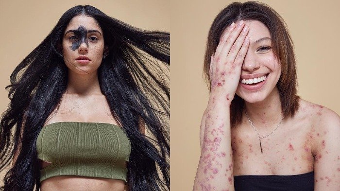 Sering Diejek Jelek, 6 Wanita Ini Buktikan Bisa Tampil Cantik dengan ...