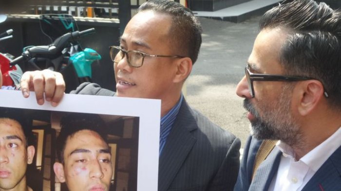 Putra Jeremy Thomas Jadi Tersangka, Polisi Punya Dua Alat Bukti ...