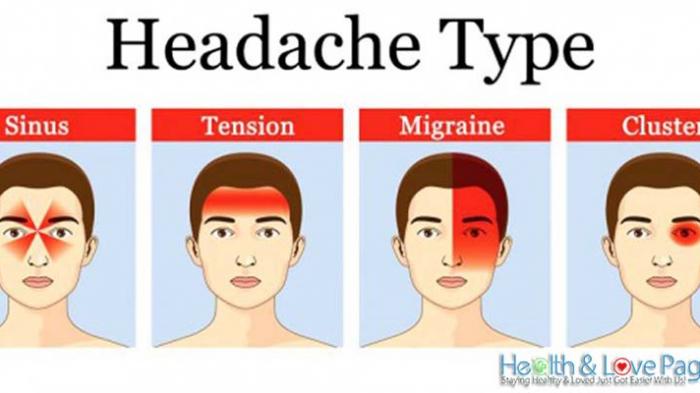 6 Titik Pijat untuk Obati Sakit Kepala, Redakan Ketegangan dan Stres ...