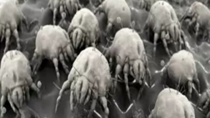 Mengenal Apa Itu Infeksi Tungau dan Cara Mengatasinya - Bangkapos.com