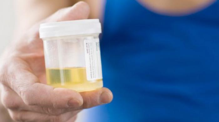 Kondisi Kesehatan Berdasarkan Warna Urin - Bangkapos.com