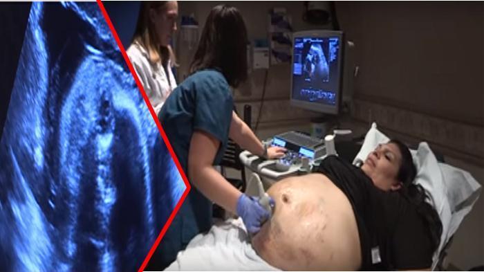 Hasil USG Sangat Mengejutkan, Ada Keanehan Pada Perut Wanita Hamil Ini - Bangkapos.com