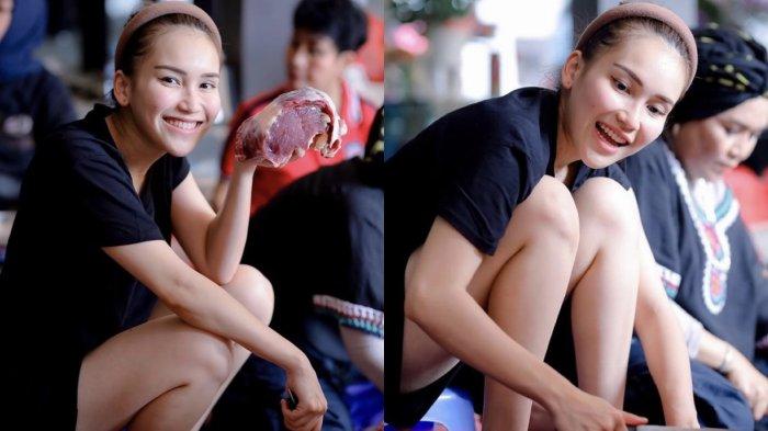 Isu Ayu Ting Ting Operasi Plastik Akhirnya Terjawab, Pantas Robby Purba dan Boy William Mendekat ...