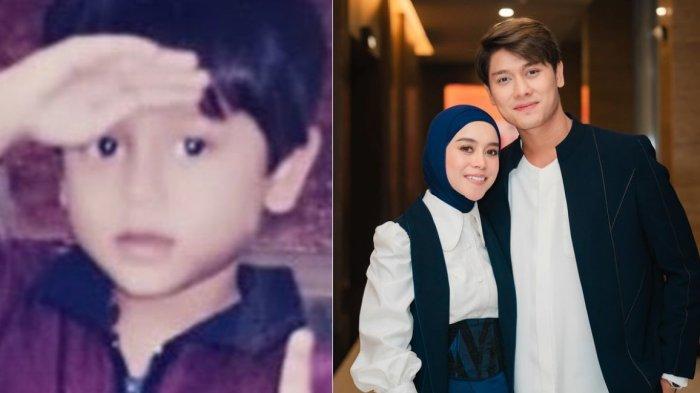 Tampang Polos Rizky Billar Jauh Sebelum Kenal Lesti Kejora, Fans Soroti ...