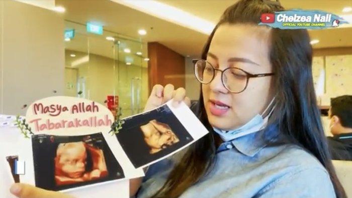 Kabar Chelzea yang Dulu Jadi Pengasuh Kiano, Ipar Baim Wong Hamil Lagi - Banjarmasinpost.co.id