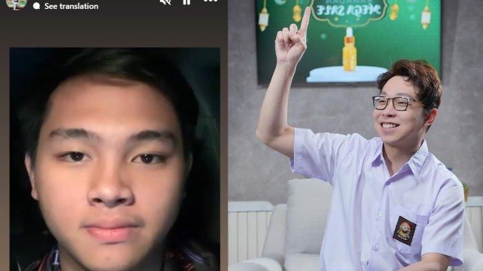 Akan Beda Cerita Jika Rp1 M, dr Richard Lee Ikhlaskan Uang Honor untuk Aldy Maldini Eks Coboy ...