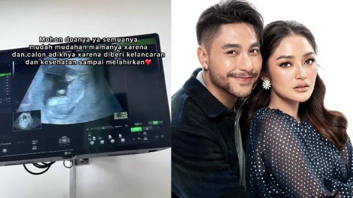 Krisjiana Baharudin Bagikan Kabar Pilu, Kondisi Rahim Siti Badriah Dibeberkan: Semua Milik Allah ...