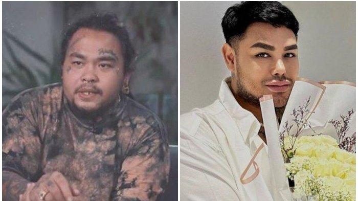 Dulu Masuk Rumah Sakit Kala Ikut MasterChef Indonesia, Kini Gandeng ...