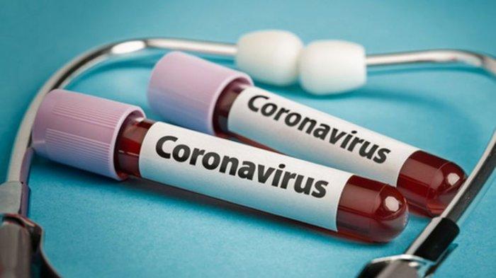 Racik Obat Virus Corona, Apoteker Ini Meninggal Dunia Saat Coba Obat ...